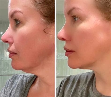 Gua Sha avant après les résultats et photos Jade Roller