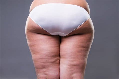7 exercices efficaces pour éliminer la graisse des cuisses et délargir