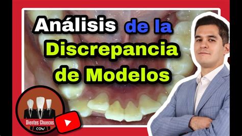 Análisis de la discrepancia de modelos YouTube