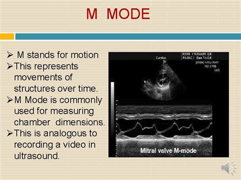 Basics Of Ultrasound Dr Mohan Kumar M S