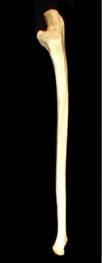 Ulna Diagram Quizlet