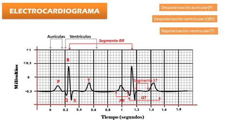 Como Interpretar Um Eletrocardiograma SOLOLEARN