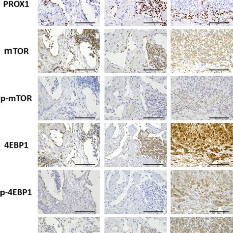 Representative Immunohistochemical Staining Patterns In Various