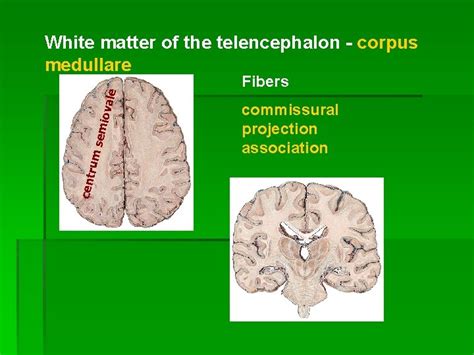 Telencephalon Structure Of Telencephalon Gray Matter Cortex Pallium