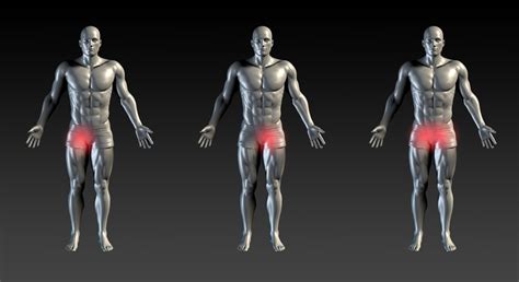 Pulled Groin Vs Hernia What Can Be Mistaken For A Hernia