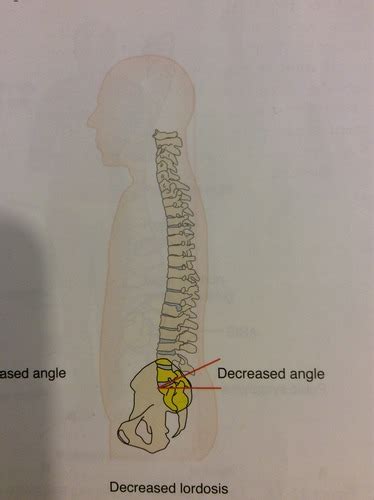 Chapter 17 Pelvis Flashcards Quizlet