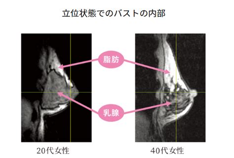 クーパー靭帯切れた写真や画像は？高校生でも切れるの？復活や再生方法！ 宮ちゃんのナイトブラ