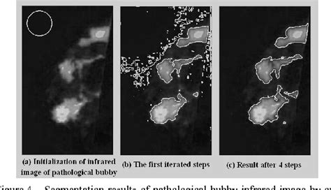 figure 4 from fast image segmentation based on single parametric level set approach semantic