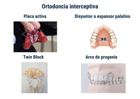 Gu A De Ortodoncia Interceptiva Cl Nica Ortiz Vig N