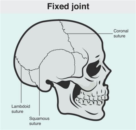 Fixed Joints