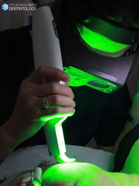Vascular Laser Treatment Laser Therapy Melbourne Skin Dermatology