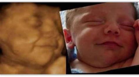 Fotos Incr Veis De Beb S Antes E Depois Do Nascimento Beb Mam E