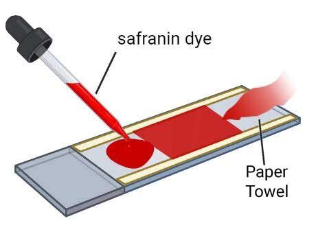 Gram Staining Principle Procedure Interpretation And Animation Artofit