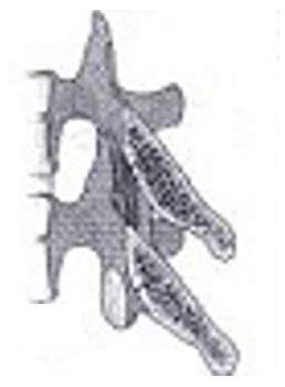 Ecograf A De La Columna Vertebral Tor Cica Dolopedia