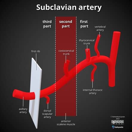 Branches Of Aorta Mnemonic Subclavian Artery Mnemonics Arteries The