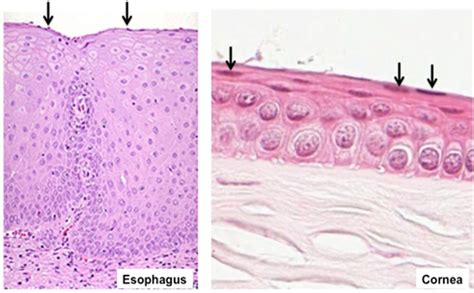 Stratified Squamous Epithelium Non Keratinized Labeled