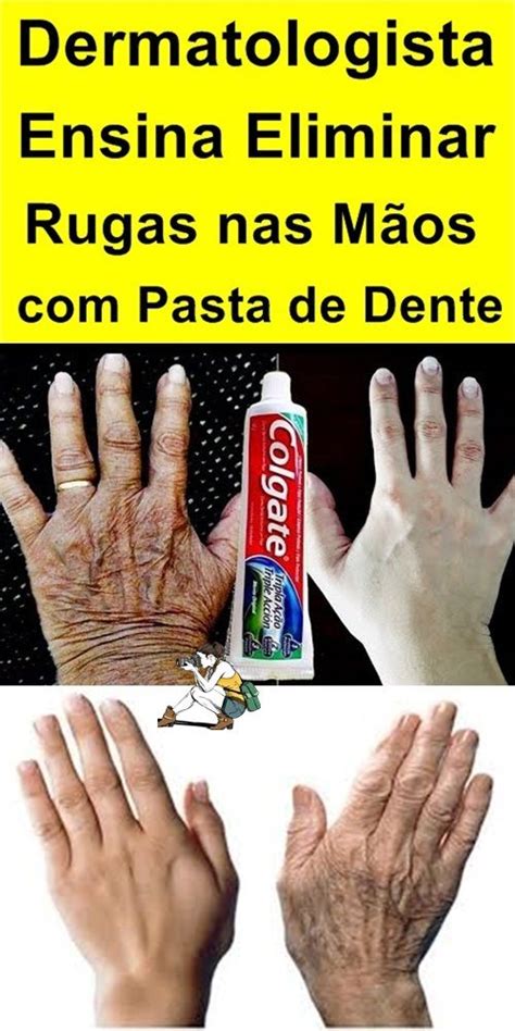 Use E Expulse Anos De Manchas E Rugas Das M Os Dicas De Beleza