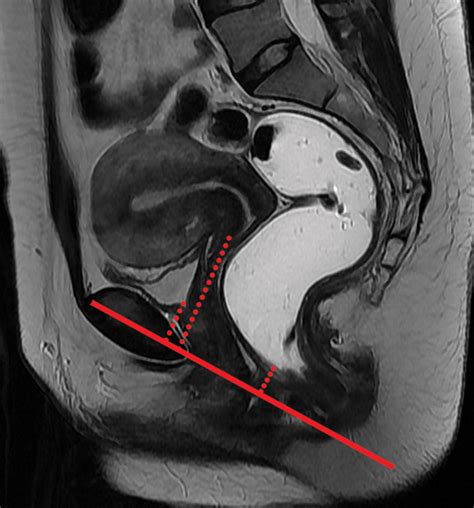 MR Imagingbased Assessment Of The Female Pelvic Floor RadioGraphics