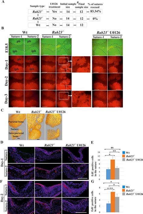 RAB23 Coordinates Early Osteogenesis By Repressing FGF10 PERK1 2 And