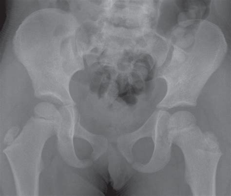 Female Pelvis Radiology Key