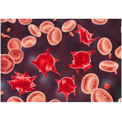 Anemia hemolítica o que é sintomas causa e como se cura Minha Vida