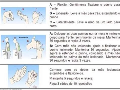 Quais Exercícios Para Prevenir Síndrome Do Túnel Do Carpo Dr Márcio
