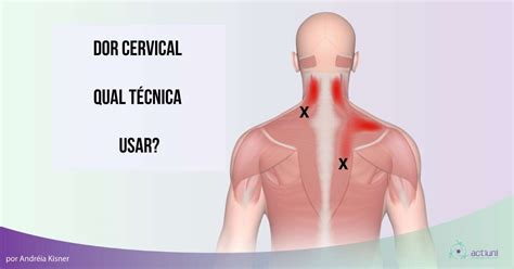 Dor Cervical qual técnica usar ACTIUNI