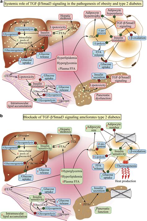 Systemic role of TGF β Smad3 signaling in the pathogenesis of type 2