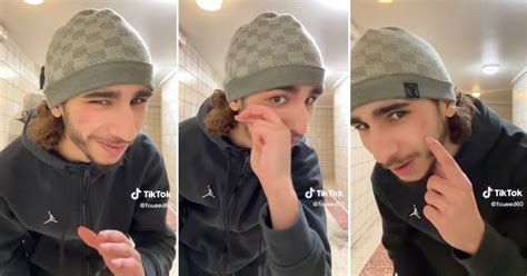 Cette Terrible Tendance Cicatrice De TikTok Pour Laquelle Des