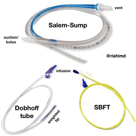 Mechanical Ventilation Interventional Radiology Sump