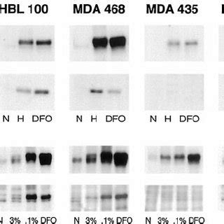Western Blot Analysis Of HIF 1 And HIF 2 Protein Expression In