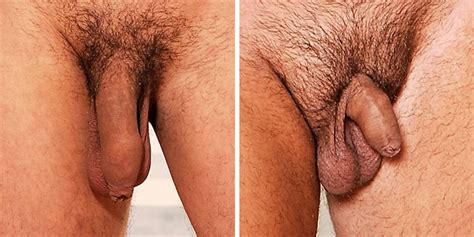 Penis Galerie Schau Welche Unterschiede Es Gibt Penis Galerie