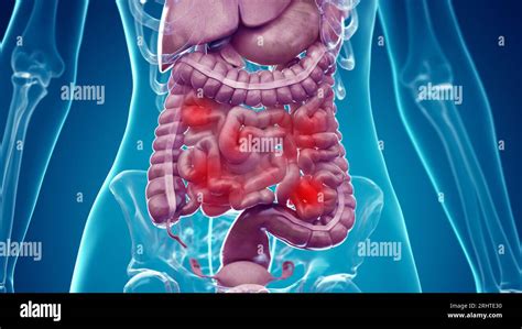 Abdominal Anatomy Of Organs Medical Illustration Shows A