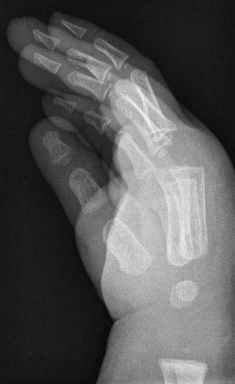Ucsd Musculoskeletal Radiology