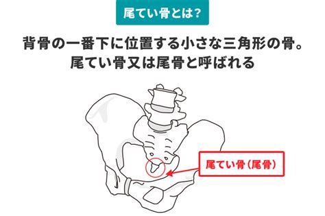 尾てい骨のヒビが痛くてつらい原因と対処法を徹底解説 交通事故病院