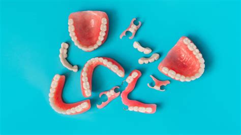 Prótese dentária removível conheça os tipos e vantagens