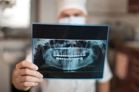 Panorámica dental Clinica Dental Sonrisa Segura