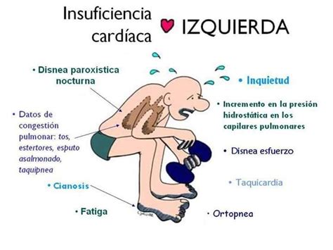 Signos y síntomas claves en la insuficiencia cardiaca Nursing