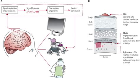 brain computer interfaces in neurological rehabilitation the lancet neurology