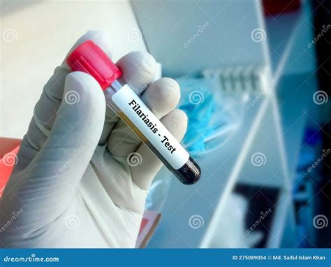 Muestra De Sangre Para La Prueba De Filariasis Foto De Archivo Imagen