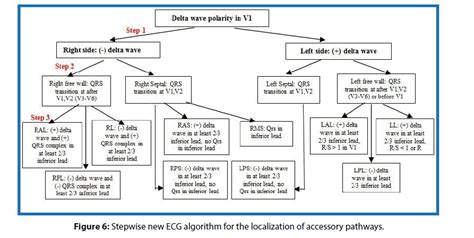 ecg algorithm