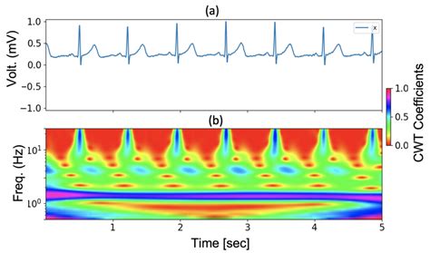 an example of tetanus ecg and continuous wavelet transform cwt a download scientific