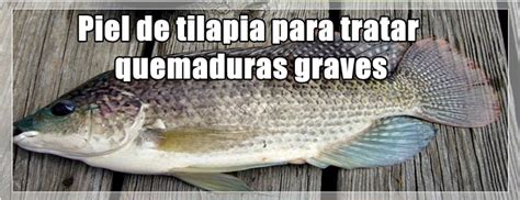 Piel De Tilapia Para Tratar Quemaduras Graves Blog De Biotopos Y