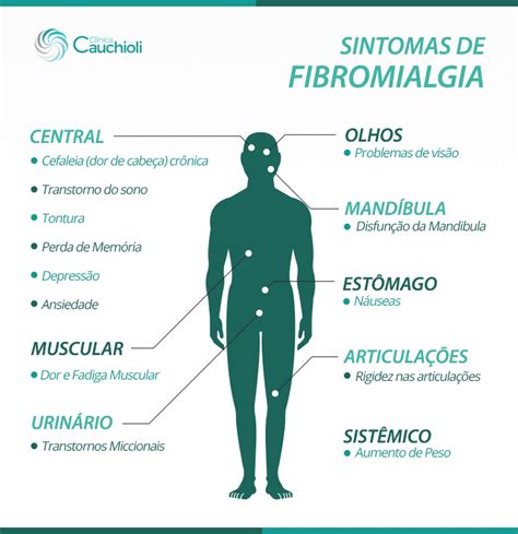 Conheça os sintomas da Fibromialgia Clínica Cauchioli