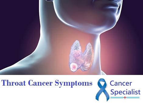 Early Warning Signs Of Throat Cancer Cancer Specialist