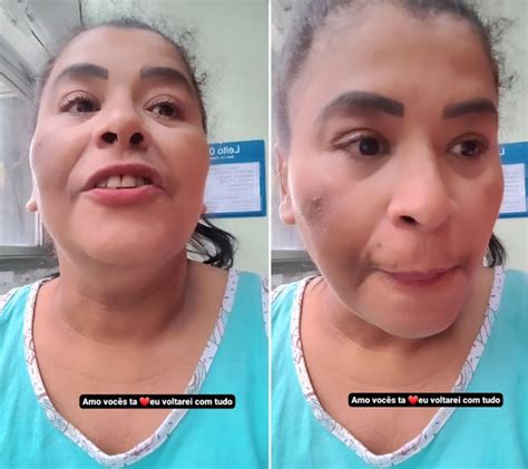 MC Katia passa por nova cirurgia Foi necessário amputar acima do joelho
