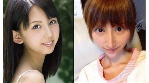 Atriz Pornô Japonesa Faz Plásticas E Fica Com ‘rosto De Funil