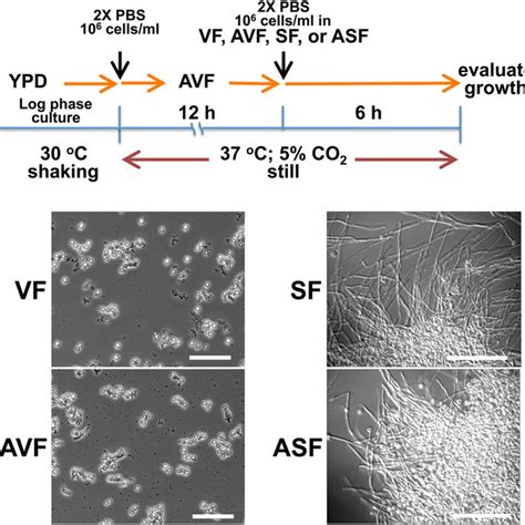 Growth Characteristics Of C Albicans In Bona Fide And Artificial