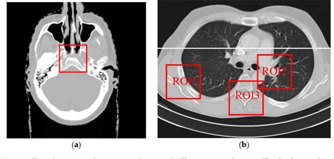 figure 1 from low dose ct image reconstruction based on structure tensor total variation using