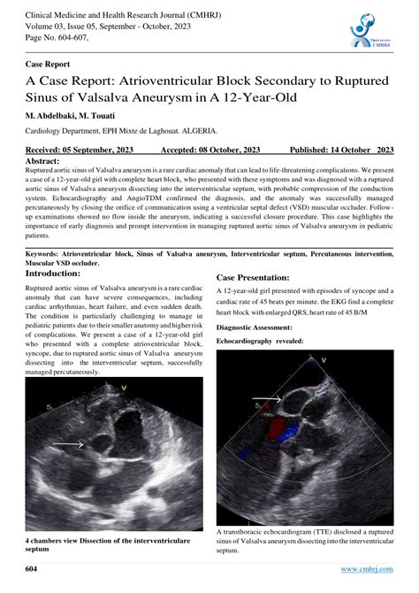 PDF A Case Report Atrioventricular Block Secondary To Ruptured Sinus